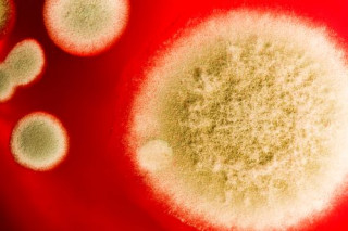 [Solved] Red Mold in Homes: What It Is & Is It Dangerous?